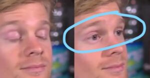 Excessive blinking in body language (5 Reasons)